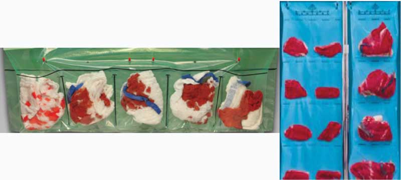 Ideas That Work: Waste Management - Outpatient Surgery Magazine - Marc ...