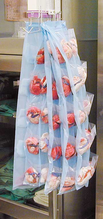 Technology to Prevent Retained Items - Outpatient Surgery Magazine - J ...