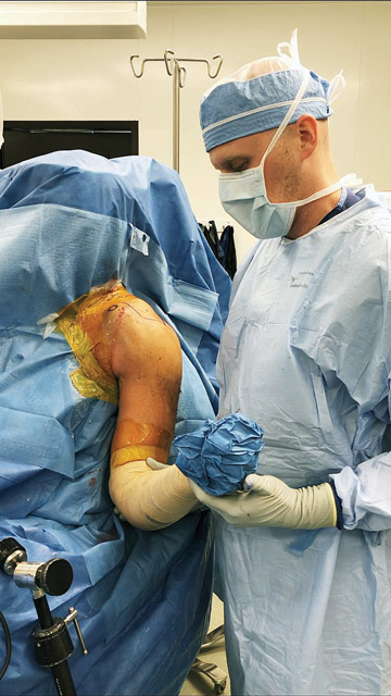 Are You Ready for the Shoulder Replacement Boom Outpatient Surgery Outpatient Surgery Magazine