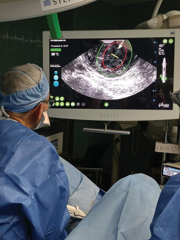 The Bright Future of 4K Video - Outpatient Surgery Magazine ...