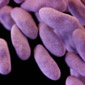 CRE Superbug Sickens 7, Kills 2 in Los Angeles Hospital - This Just In ...