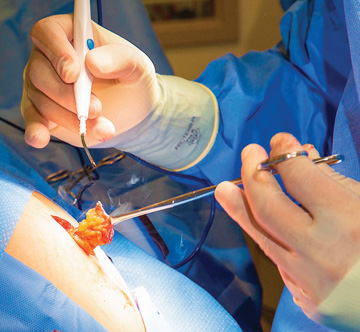 Fighting for Smoke-Free ORs - Outpatient Surgery Magazine | Outpatient ...